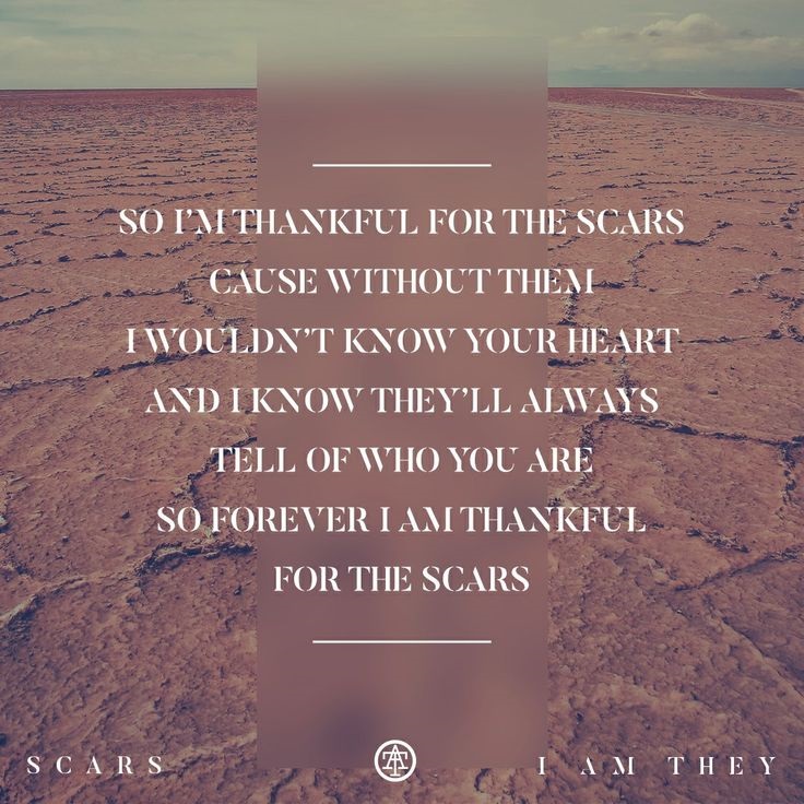 Thankful for the Scars – Janesville Apostolic Ministries